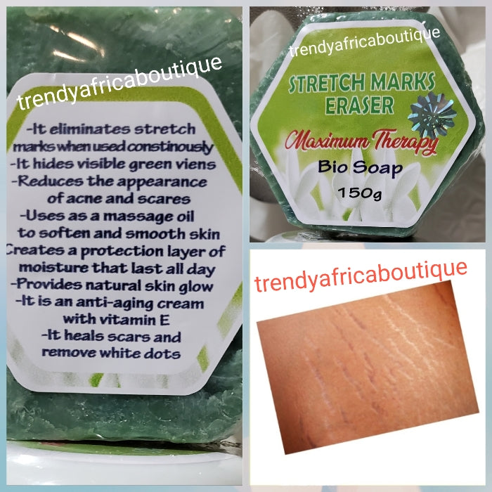 Evob Stretch Marks Eraser maximum therapy Bio soap 150g x 1 soap. Trea ...
